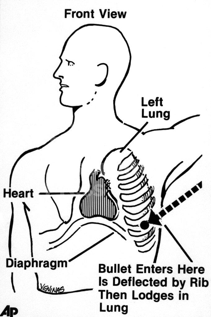 Ronald Reagan Assassination Attempt 1981 | Buy Photos | AP Images ...
