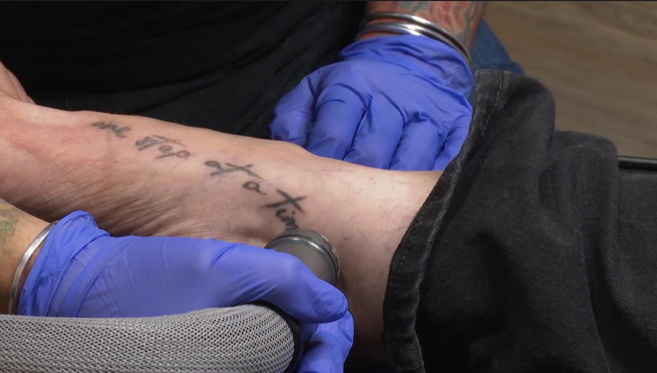 If you want that tattoo erased it's going to hurt and it's going to ...