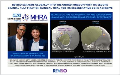 RevBio Expands Globally into the United Kingdom with its Second Cranial ...
