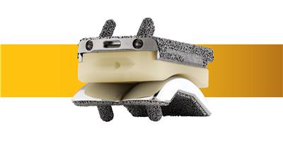 First Surgeries Using Stryker’s Infinity With Adaptis and Everlast ...